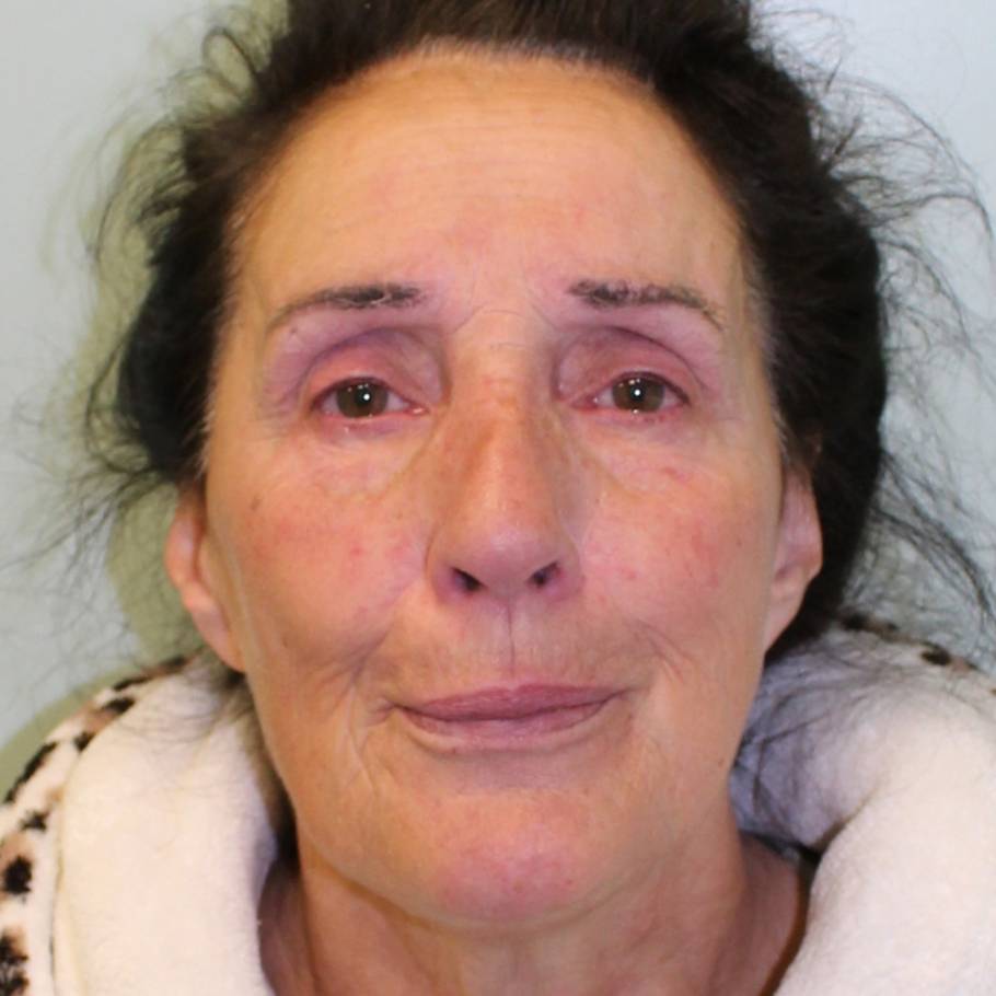 Eldri konu haldið sem þræl – Varð að borða kattamat til að lifa af - DV