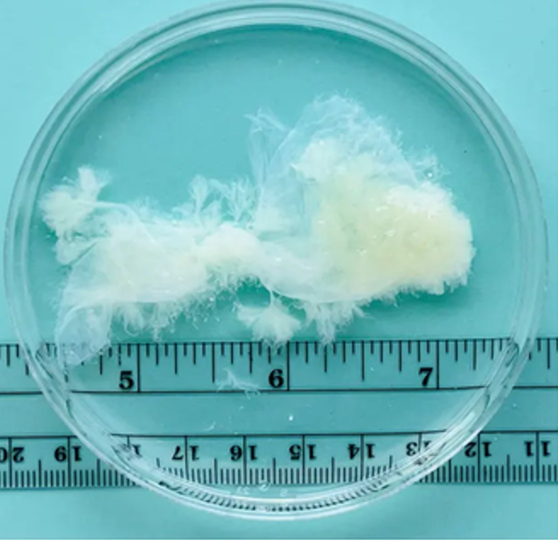 Myndir frá fyrstu vikum meðgöngu - Margir trúa ekki að þær séu ...