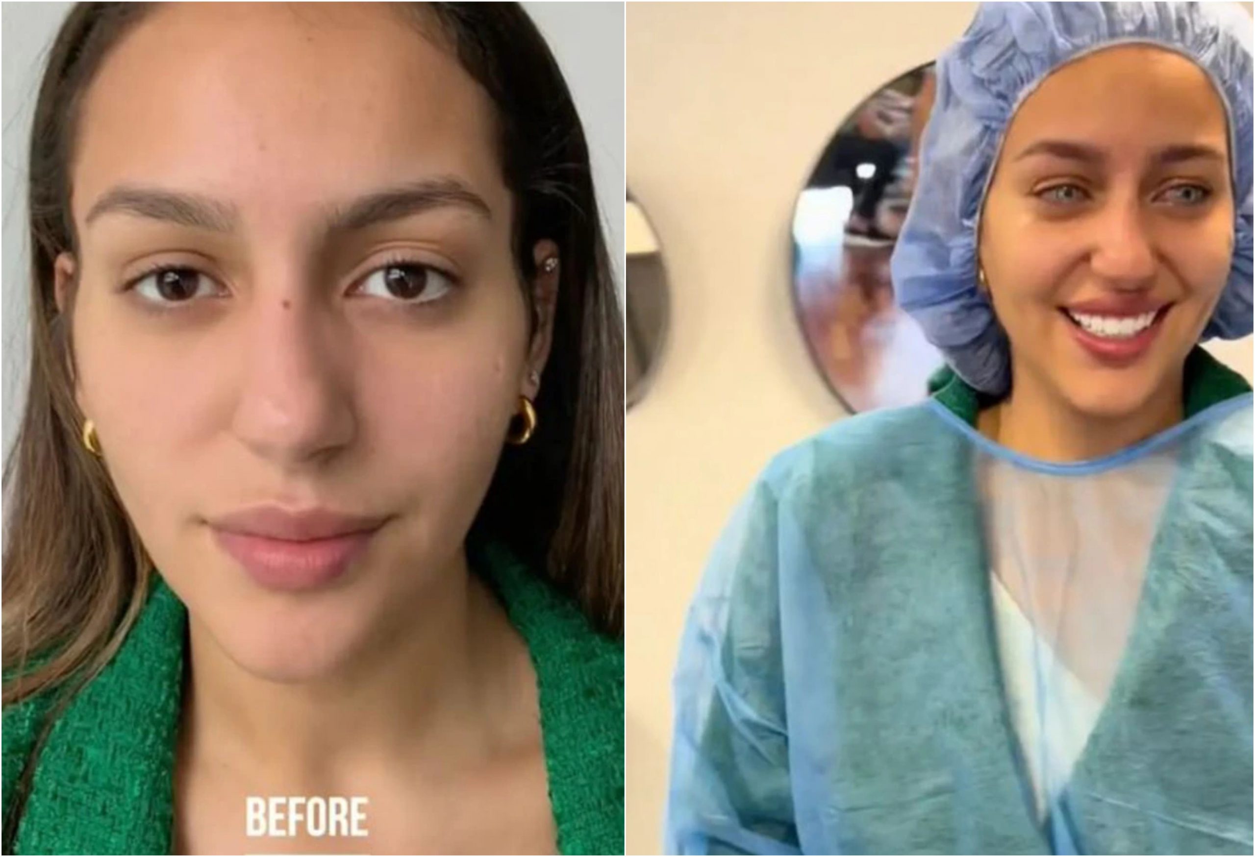 Varar fólk við að gera ekki sömu mistök og hún – Nánast blind eftir ...