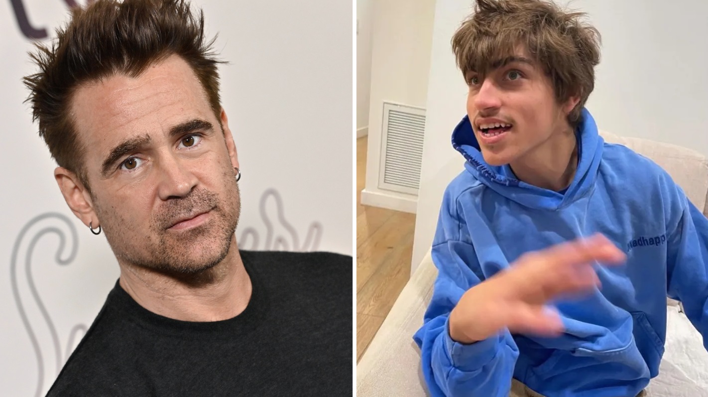 Colin Farrell opnar sig um son sinn sem fæddist með sjaldgæft heilkenni ...